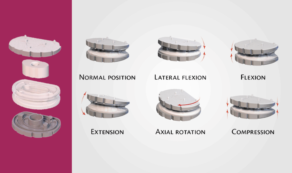 Motion Preserving - ONZ
